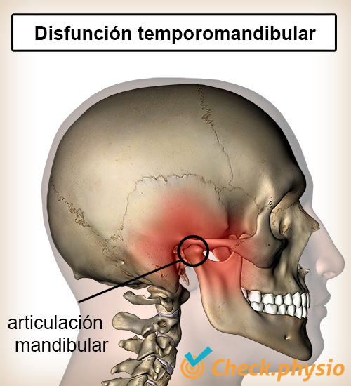 Disfunción temporomandibular | Causa, síntomas y tratamiento